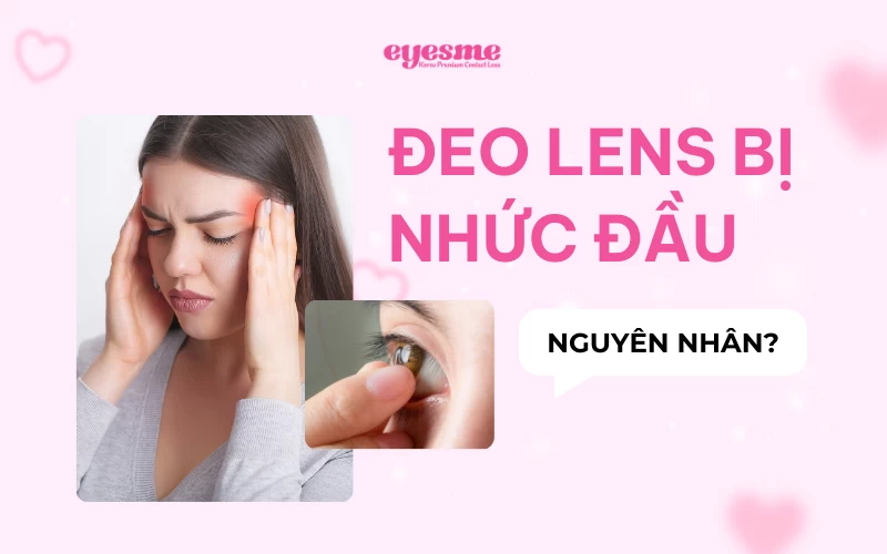 Đeo Lens Bị Nhức Đầu – Nguyên Nhân Và Cách Khắc Phục - Kính áp tròng ...